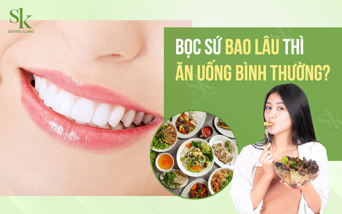 Giải đáp: Bọc răng sứ bao lâu thì ăn uống bình thường?